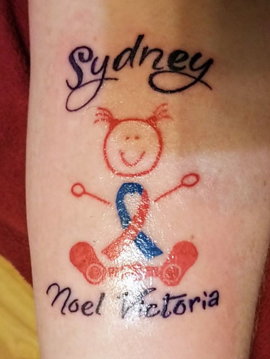 Tattoo uploaded by Alicia Goobie • Clubfoot ribbon with my daughter's ...