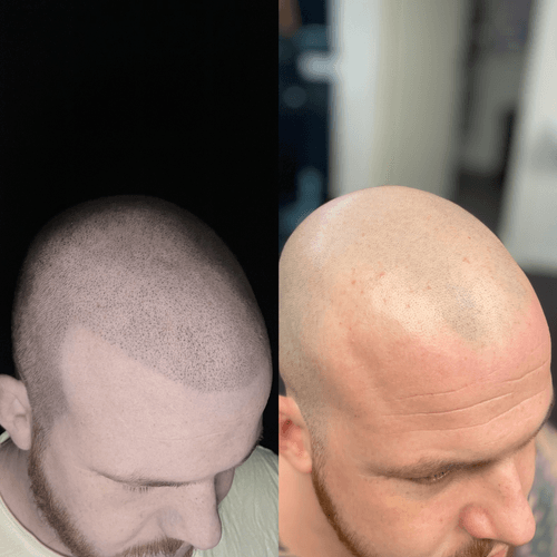 Tattoo uploaded by Christian Boye larsen • Tattoodo