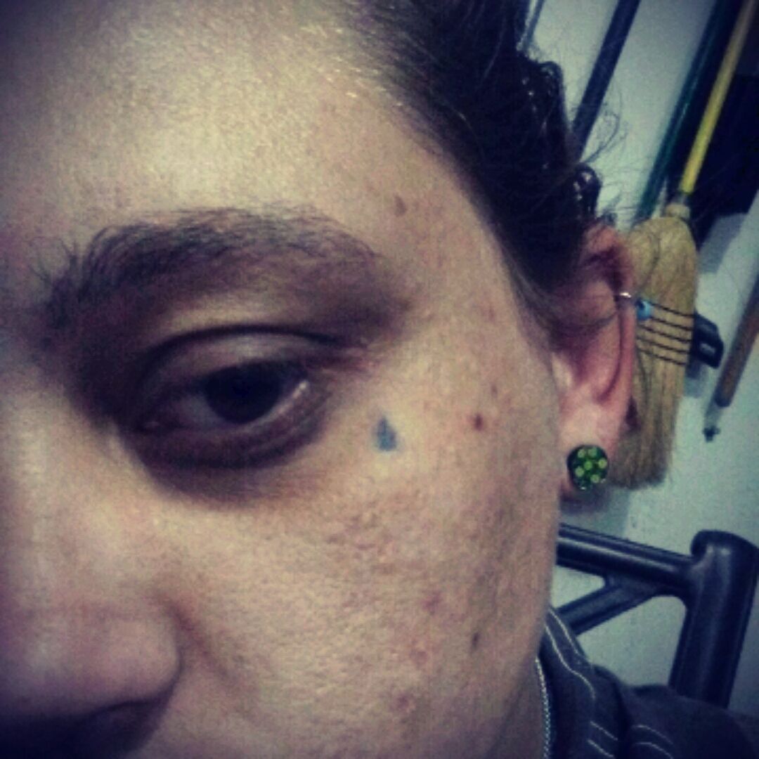 Teardrop Piercing Scar